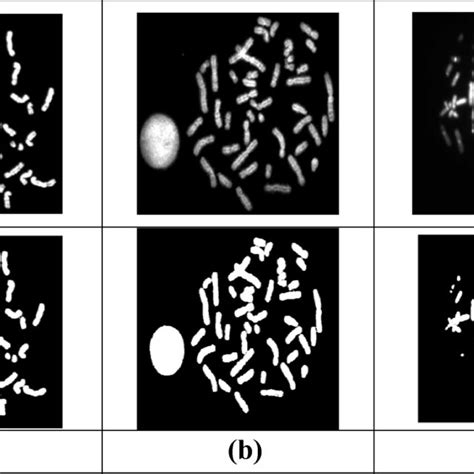 Segmentation Results For Watershed Transformation Download Scientific Diagram
