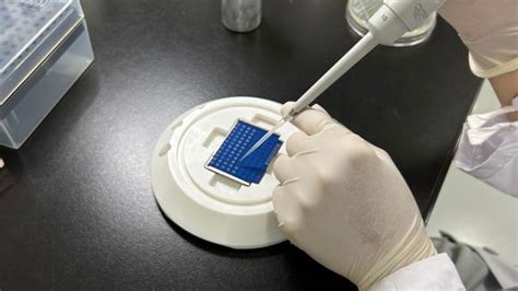 【微生物の迅速同定】 Maldi微生物同定試験 P2tsg1000002 1 ｜サイサチ受託カタログ