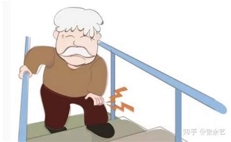 膝关节磨损不可逆！6招教你且行且珍“膝” 知乎