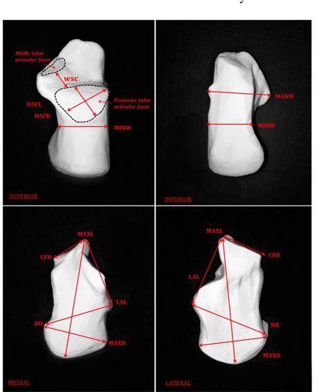 Figure 1 From Sexual Dimorphism Of The Calcaneus In Contemporary Cretans Semantic Scholar