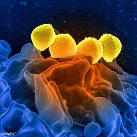 Group A Streptococcus Gas Streptococcus Pyogenes Bacteria Which Were At… Centers For