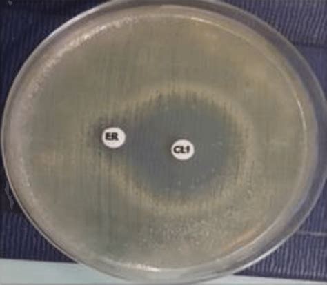 A Circular Zone Around The Clindamycin Disk And Resistant To The Download Scientific Diagram