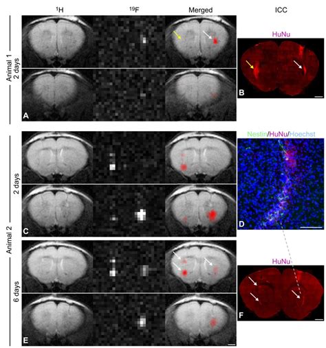 Advances In Using Mri Probes And Sensors For In Vivo Cell Tracking As