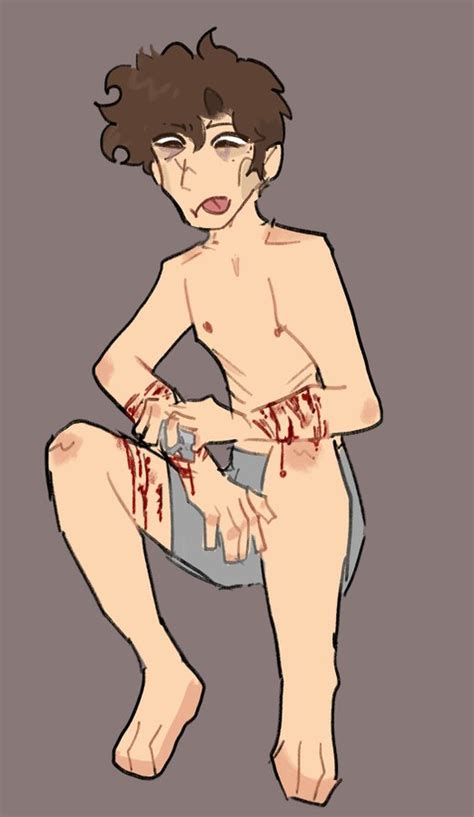 Rule 34 Cuts Male Male Only Self Harm Self Harm Scars Skinny