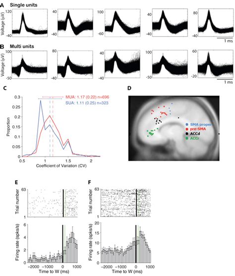 Internally Generated Preactivation Of Single Neurons In Human Medial Frontal Cortex Predicts