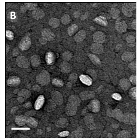 Schematic Diagram Of High Density Lipoprotein HDL Metabolism In The Download Scientific
