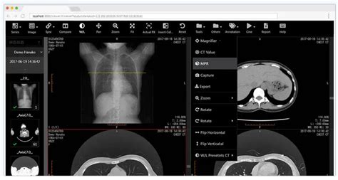 Ohif Dicom Viewer Legiit