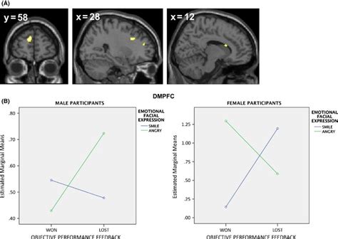 Brain Areas Within Which There Were Significant Sex Differences During Download Scientific