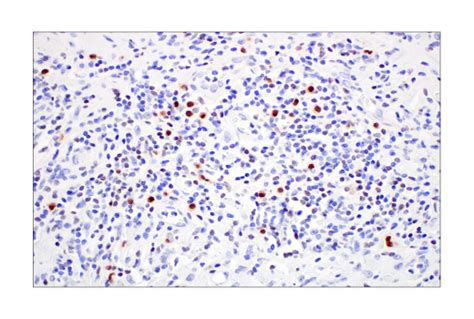Irf 8 E6j8q Xp® Rabbit Mab Bsa And Azide Free Cell Signaling