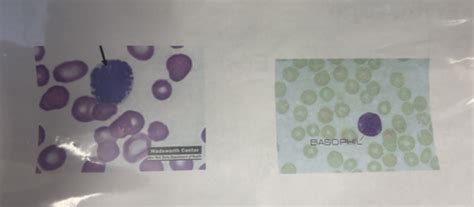 Cardiovascular System Part 1 Bio 223 Lab Flashcards Quizlet