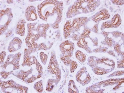 Ddr2 Antibody