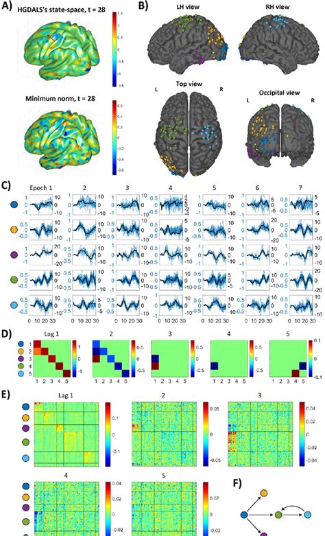 large scale simulation based on simulated meg data a hgdals s top