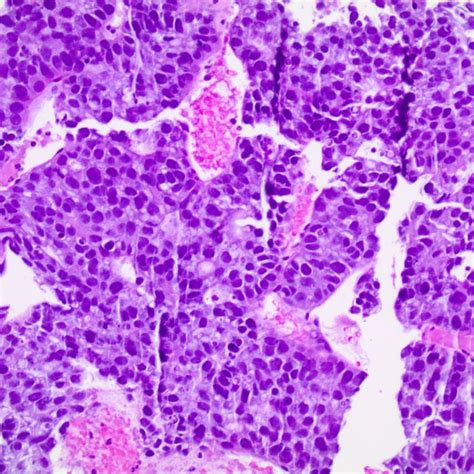 Hematoxylin And Eosin Hande Stained Histologic Sections 200x
