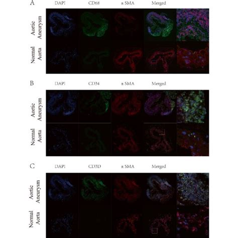 Rna Fish Of The Normal Aorta And Aortic Aneurysm Dual Hybridization Of