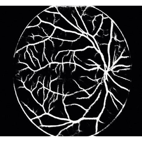 Segmentation Of Vascular Structures And Extracted Vascular Centerlines