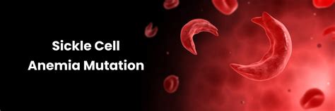 Sickle Cell Anemia Genetics Diagnosis And Treatment