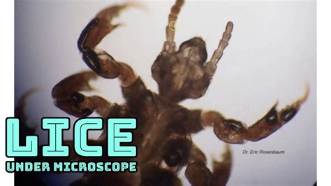 Louse Under Microscope