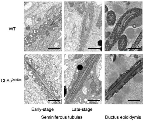 Transmission Electron Microscopy Of Mitochondria During Spermatogenesis Download Scientific