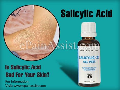 Is Salicylic Acid Bad For Your Face At Charles Blalock Blog