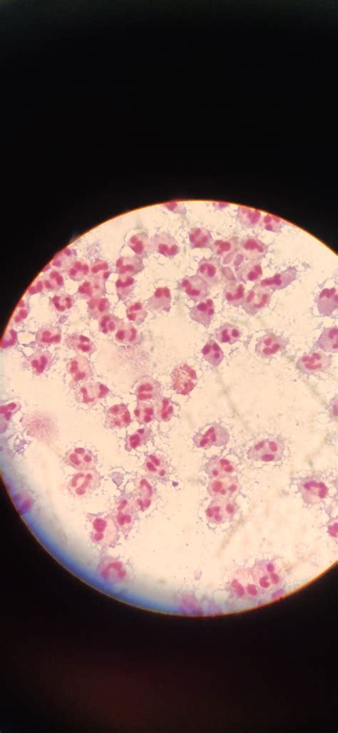 Dr Dhanji Rajani Auf Linkedin Intracellular Gram Negative Cocci