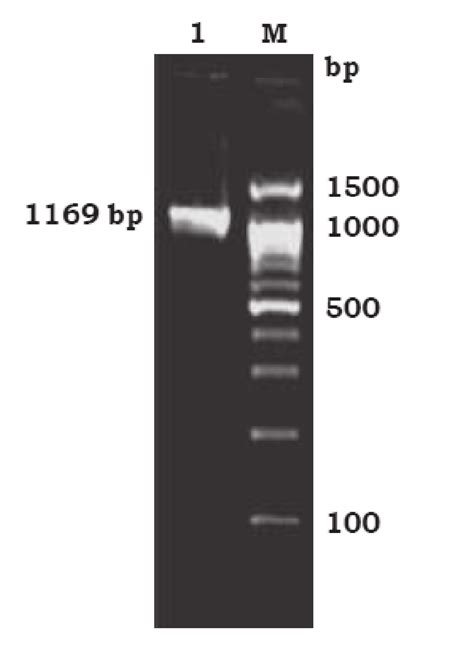 Amplification Of Ompc Gene Resulting In Pcr Product Of 1169 Bp In