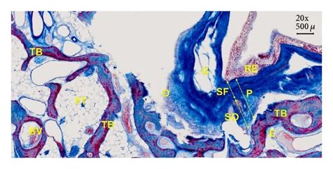 Section Through A Human Maxillary Sinus Specimen After Detachment Of