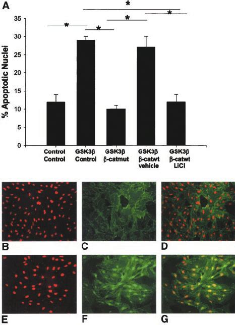A Upregulation Of ␤ Catenin Inhibits Apoptosis Induced By Gsk3