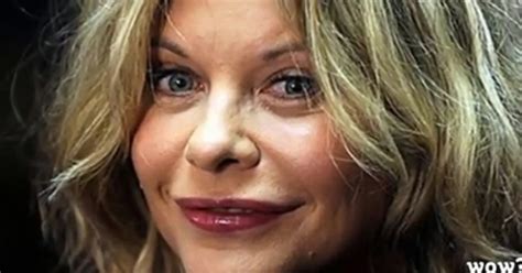 맥 라이언 성형중독충격 외모에 네티즌 경악