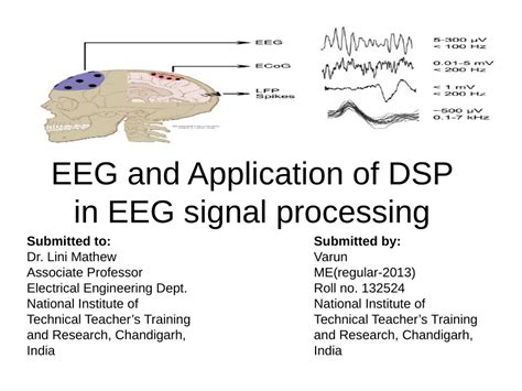 PDF EEG And Application Of Digital Signal Processing In EEG Signal