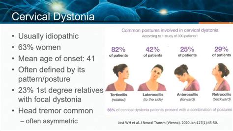 Mayo Clinic Cervical Dystonia