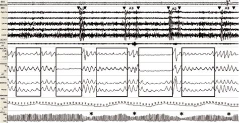 Modulation Of Eeg Responses Based On Respiratory Events Respiratory Download Scientific