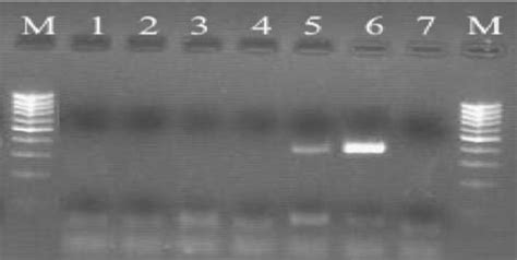 Mycoplasma Bovis Detection Lane 5 In Raw Milk Sample Collected From Download Scientific