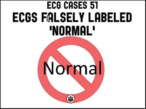 Sign Falsely Định Nghĩa Ví Dụ Câu Và Cách Sử Dụng Cụm Từ Này Sign Falsely Định Nghĩa Ví Dụ Câu Và Cách Sử Dụng Cụm Từ Này