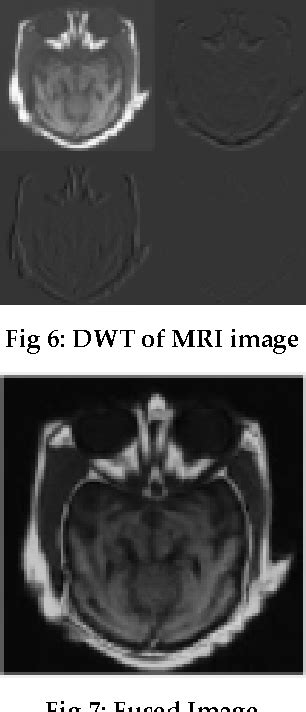 Figure 1 From Vlsi Implementation Of Medical Image Fusion Using Haar Transform Semantic Scholar