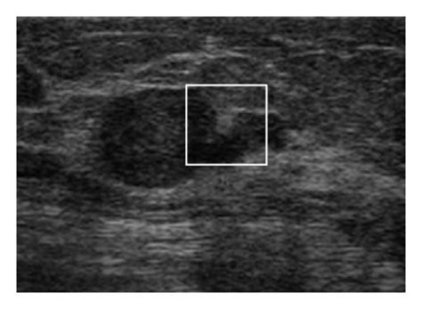 Comparison Between Original Gvf Field Niter 10 And Improved Gvf Download Scientific Diagram