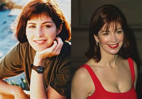 Dana Delaney Plastic Surgery Botox Injections Before And After Photos