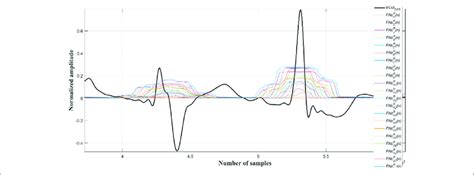 Ecg D20 Record 104m Mitdb And Fnc R Q N Q ϵ 1 21