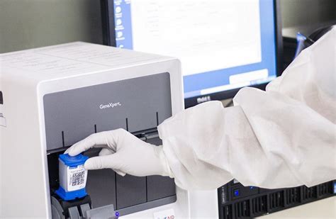 Who Announces First Prequalification Of A Tb Diagnostic Test