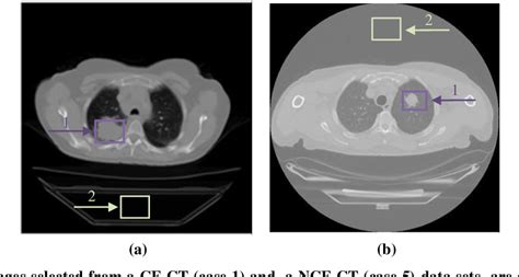 Figure 3 11 From Tumour Grading And Discrimination Based On Class