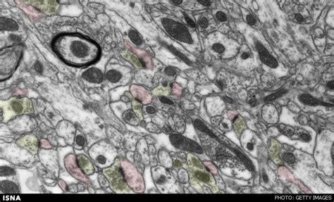 دنیای پیچیده و رنگی درون مغز در تصاویری خارق‌العاده تسنیم