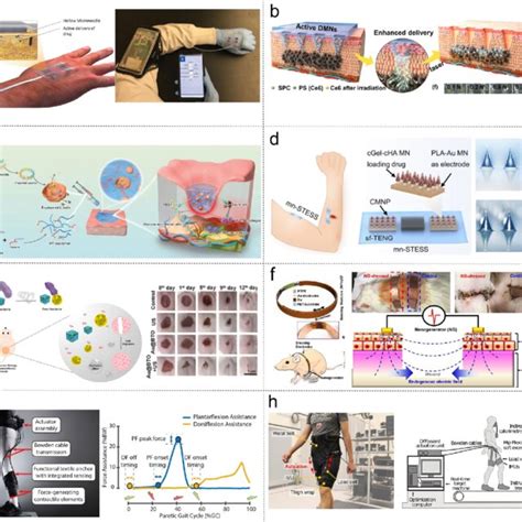 Wearable Electronics For Wound Healing Drug Delivery And