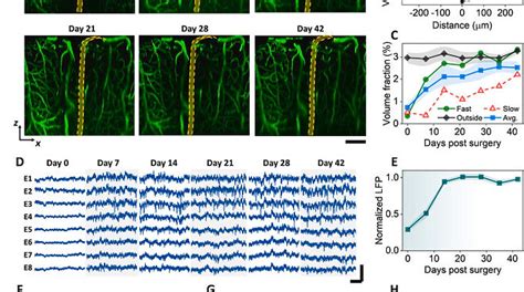 34 Longitudinal Neural And Vascular Recovery Following Ultraflexible Neural Electrode