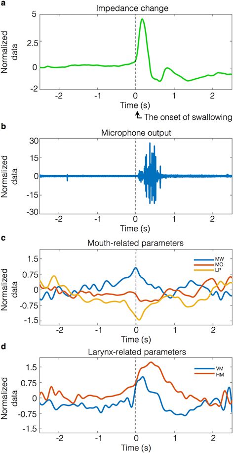 Representative Waveforms Of Participant 1 These Waveforms Were Traced Download Scientific