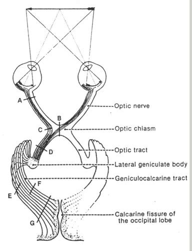 Lecture 13 Visual System 2 Flashcards Quizlet