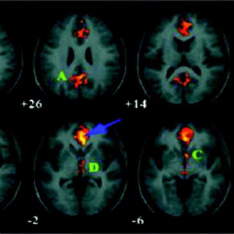 Resting State Networks Showing The Formation Of Functionally Linked Download Scientific Diagram