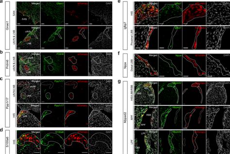 Histological Validation Of Ccs Component And Regional Download