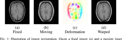 Figure 1 From Unsupervised End To End Learning For Deformable Medical