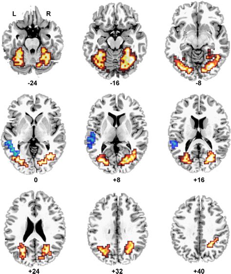 Orthographic And Non Orthographic Static Stimuli Voxelwise P 005 Download Scientific