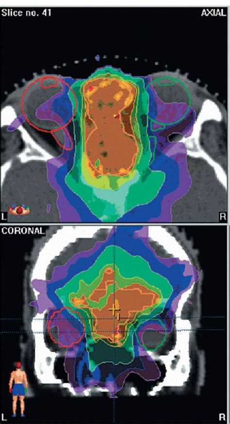 Неврология И Нейрохирургия Учебник Desten
