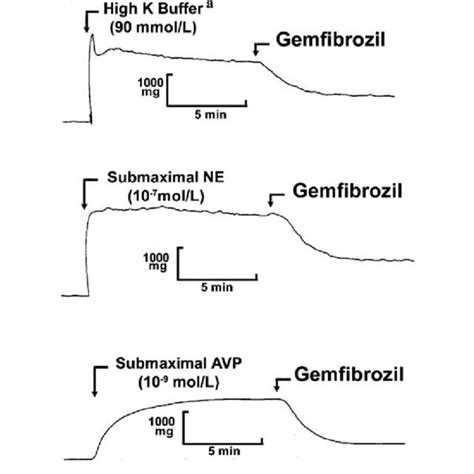 Representative Chart Recordings Of Acute Relaxant Effects Of Download Scientific Diagram